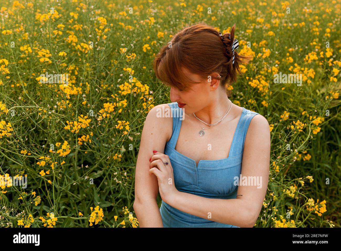 The girl has an allergic reaction to the pollen of yellow rapeseed ...