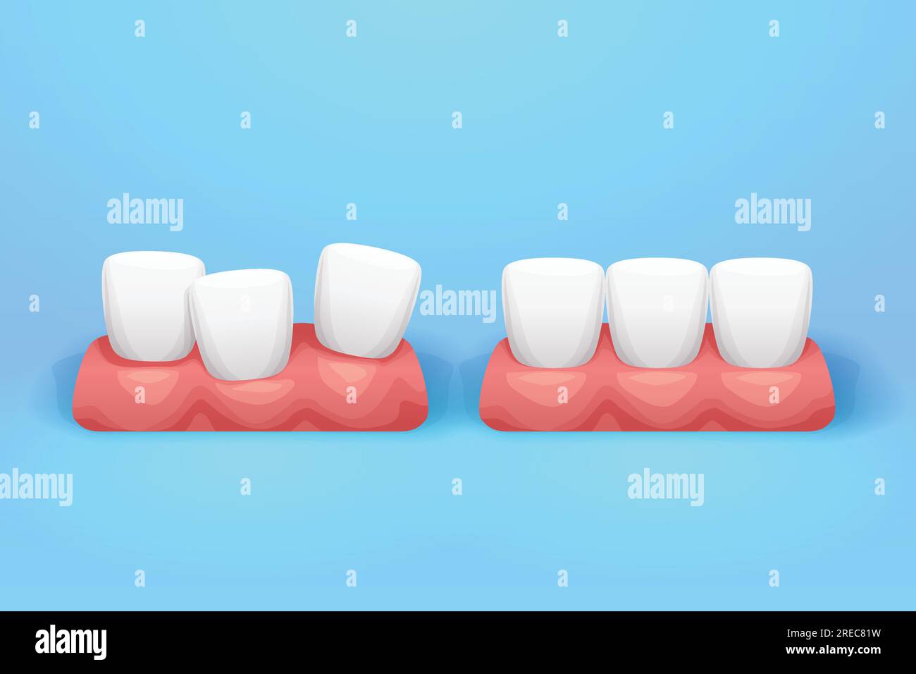 Curved model Stock Vector Images - Alamy