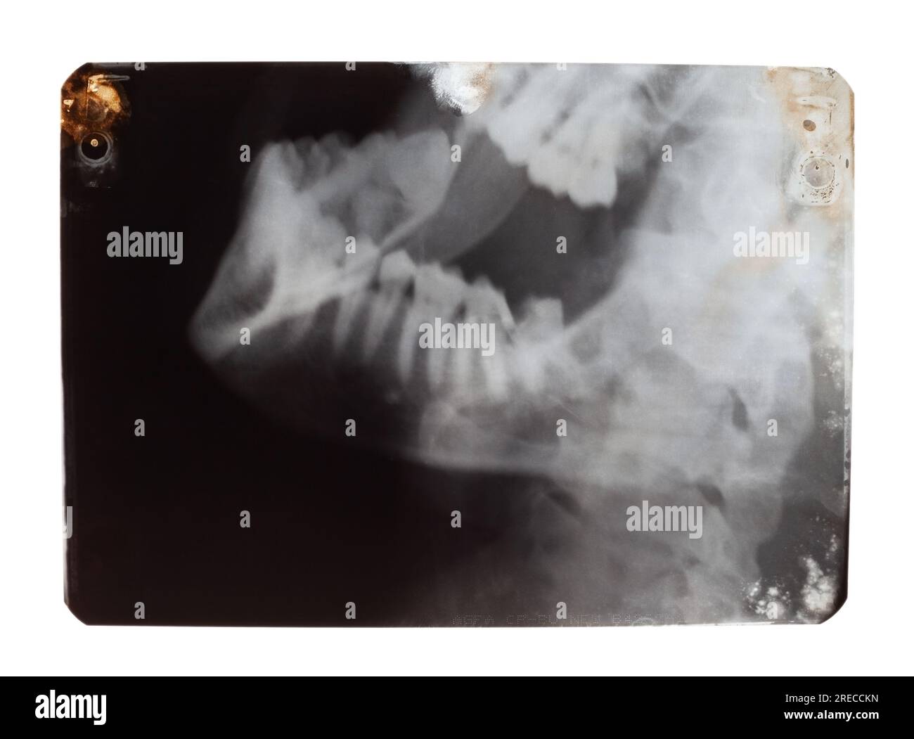 Radiography background Cut Out Stock Images & Pictures - Alamy