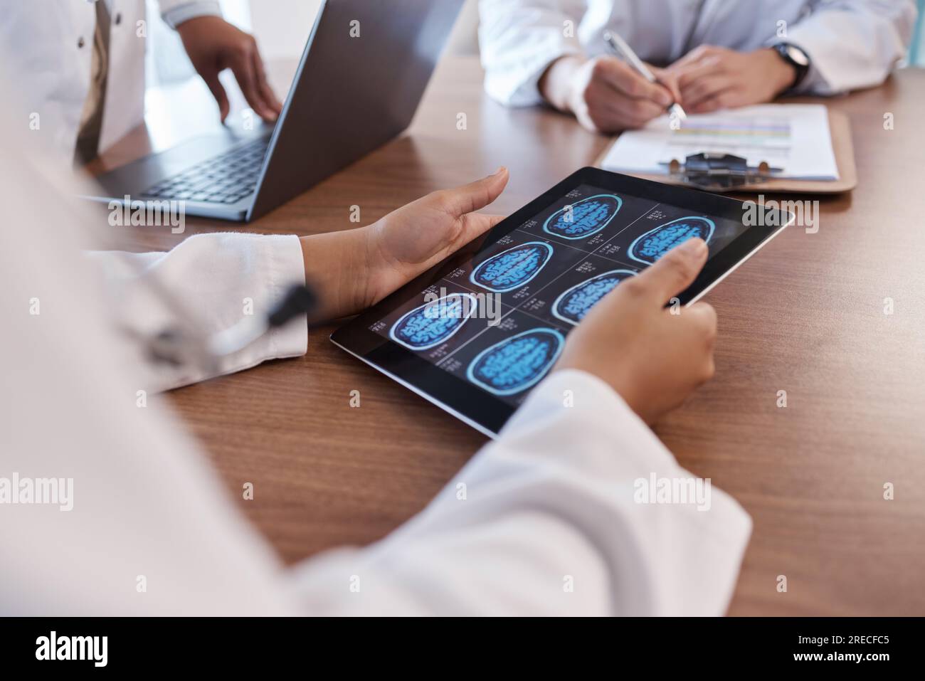 Doctor, tablet screen and hands of person with brain scan MRI, cancer ...