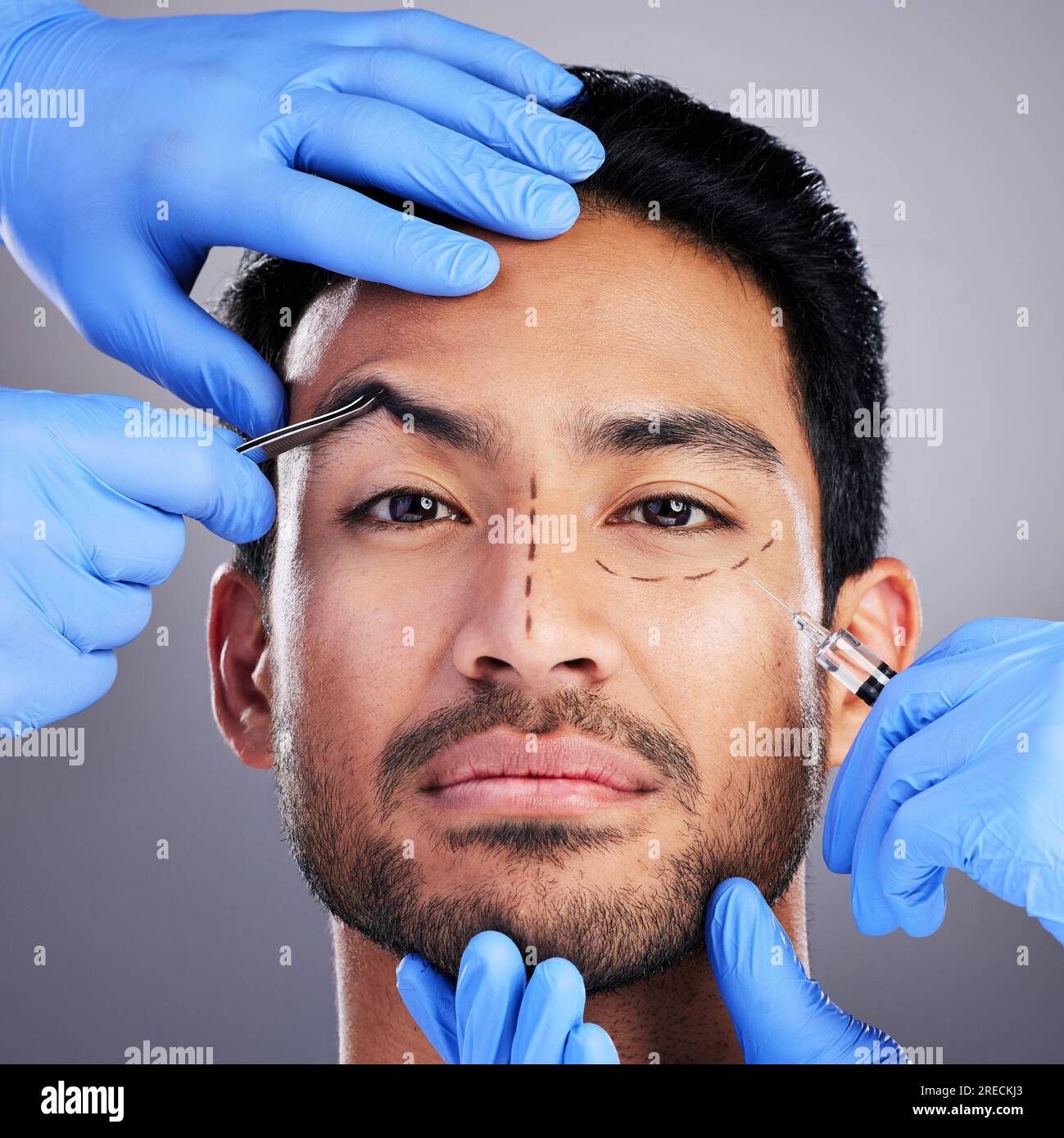 Plastic surgery, brow lift and drawing with portrait of man and surgeon ...