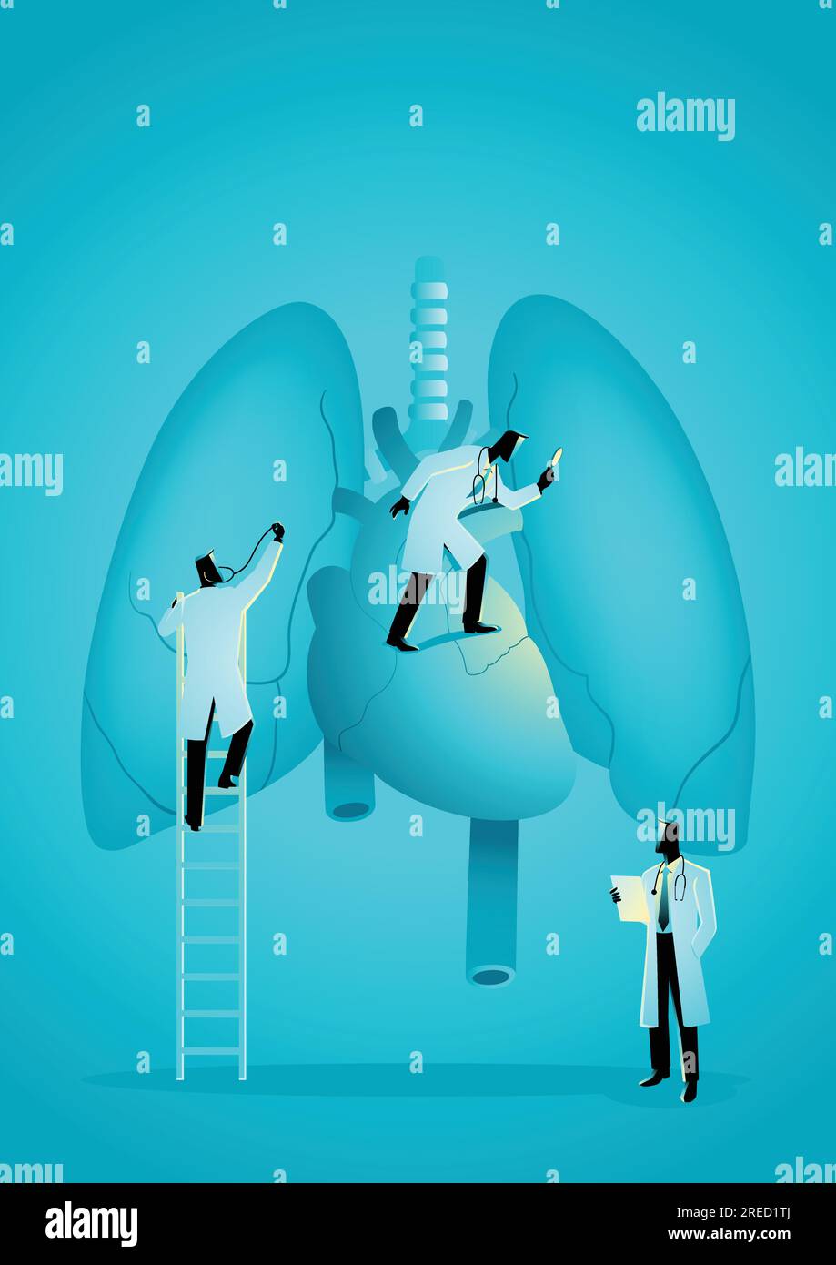 Vector graphic illustration of team of doctors diagnose human lung and ...