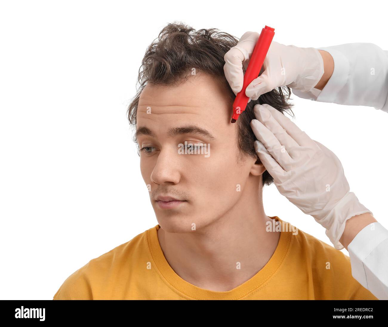 Doctor marking young man's forehead with hair loss problem on white ...
