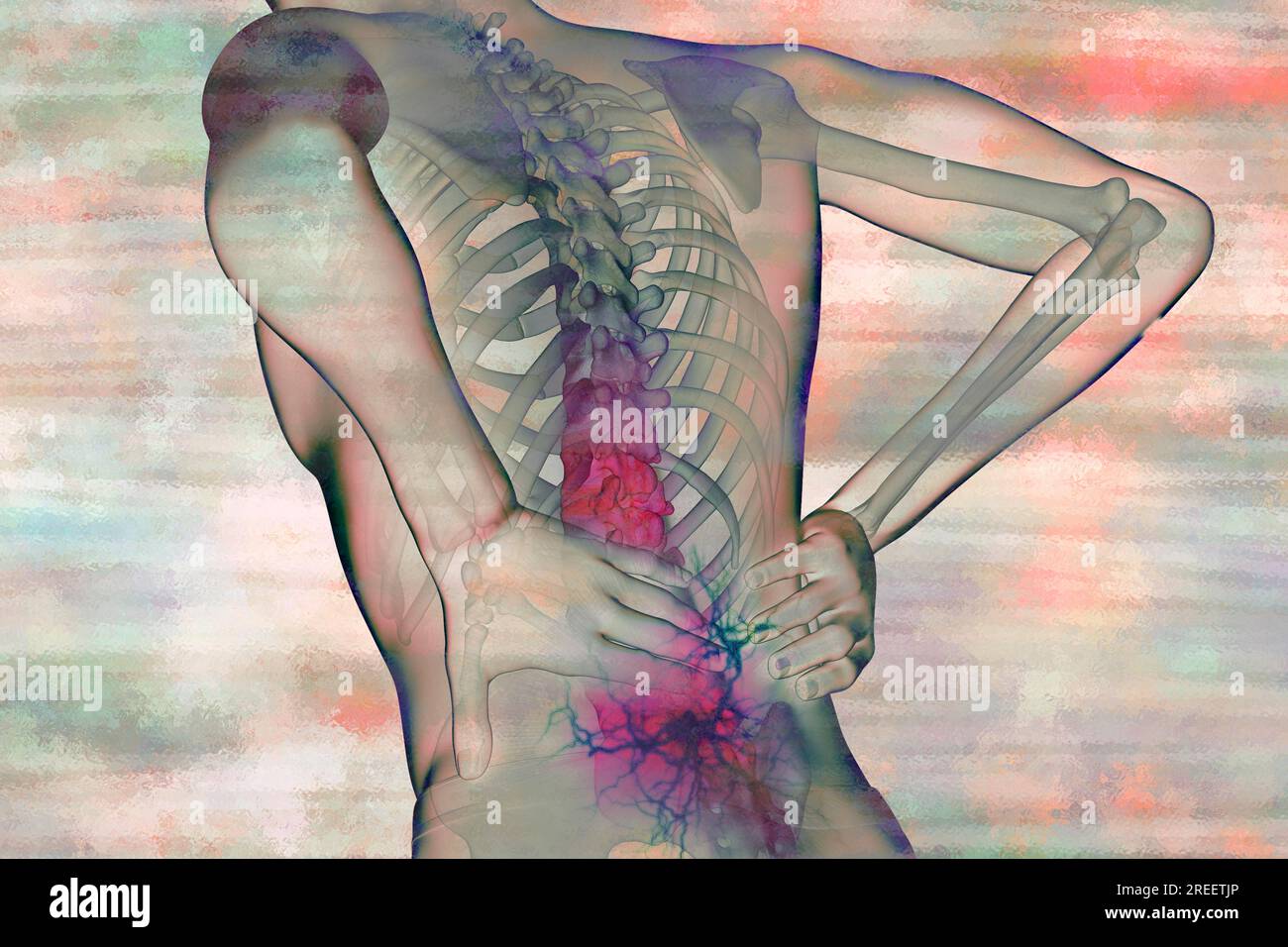 Back pain is a common condition and is particularly caused by sedentary ...