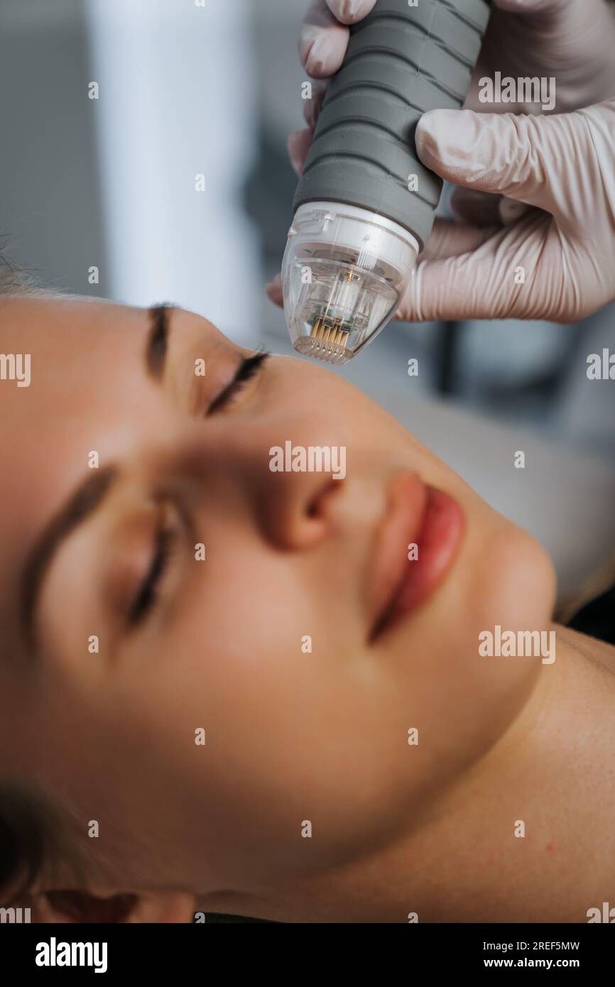 Microneedle RF lifting in a beauty salon. Big plan Stock Photo - Alamy
