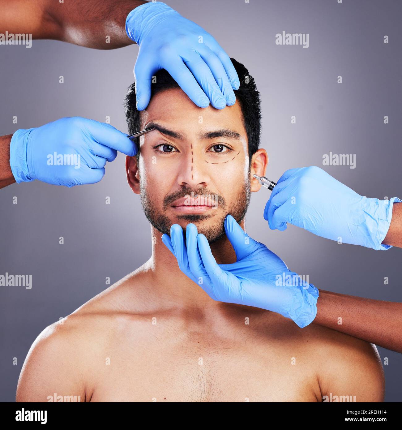 Plastic surgery, hands and drawing with filler portrait of man and ...