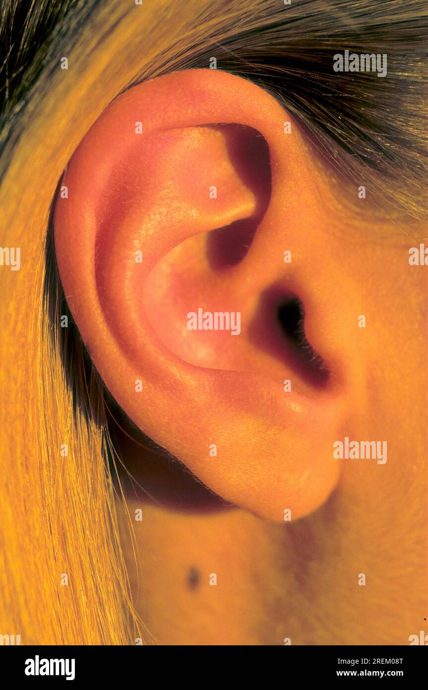 Ear, mole behind the ear, right Stock Photo - Alamy
