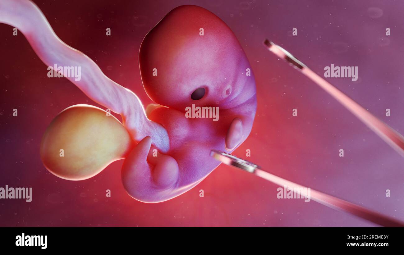 Abortion, conceptual illustration Stock Photo - Alamy