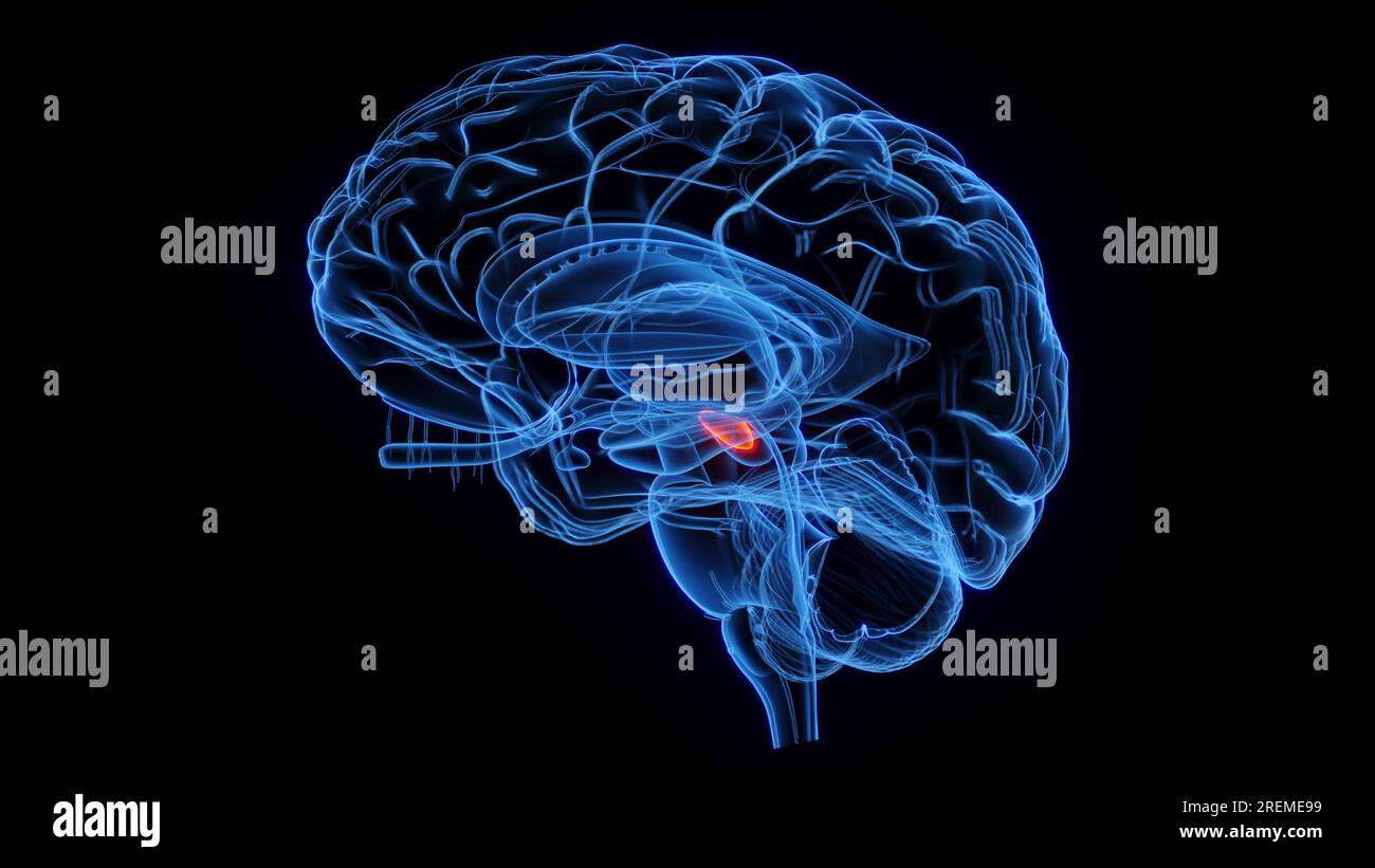 Subthalamic Nucleus Anatomy