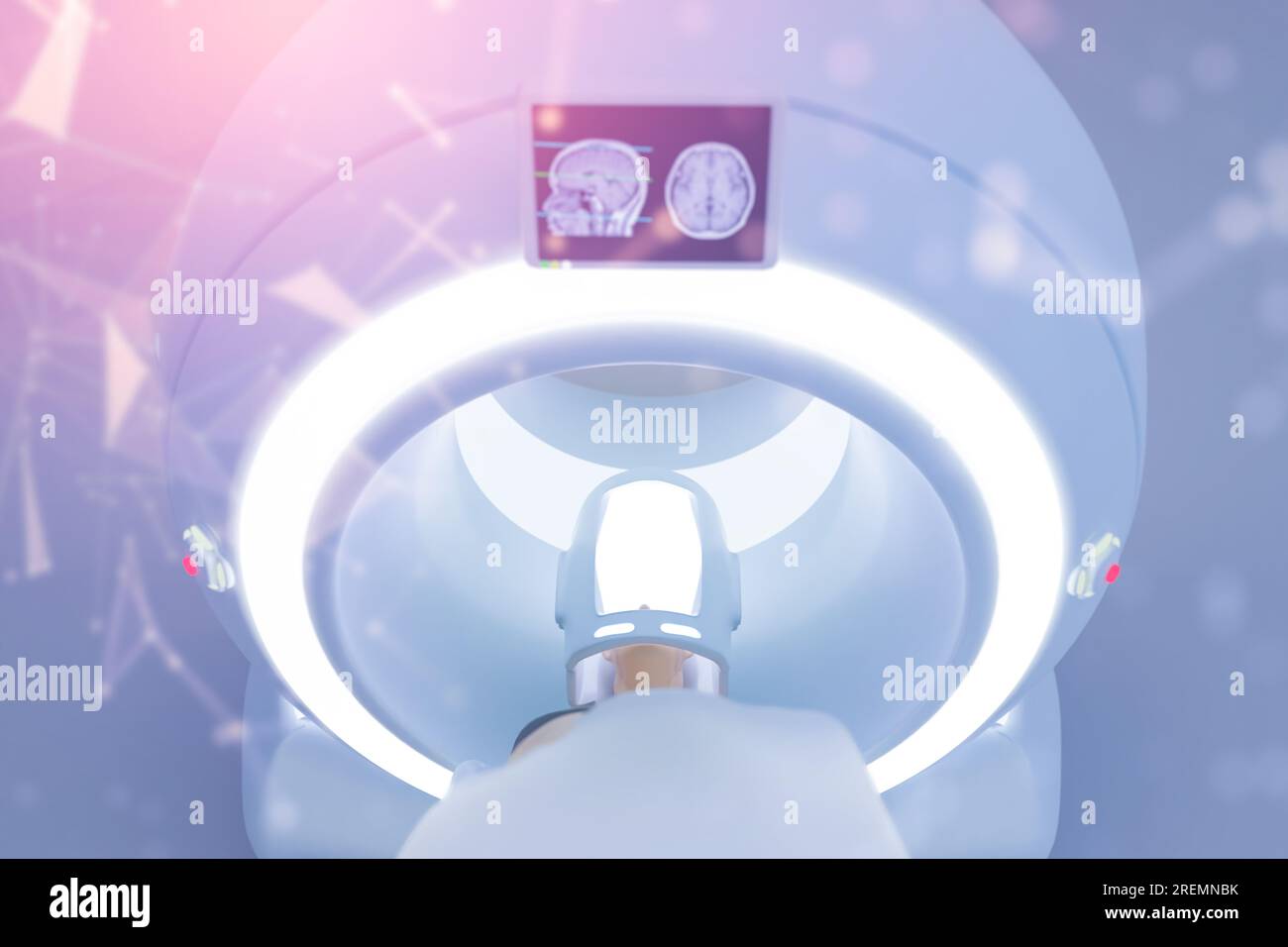 Patient undergoing MRI - Magnetic resonance imaging in Hospital ...