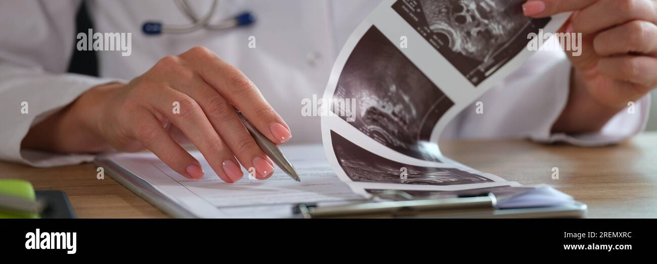 Close up of female doctor checking medical results at workplace in ...