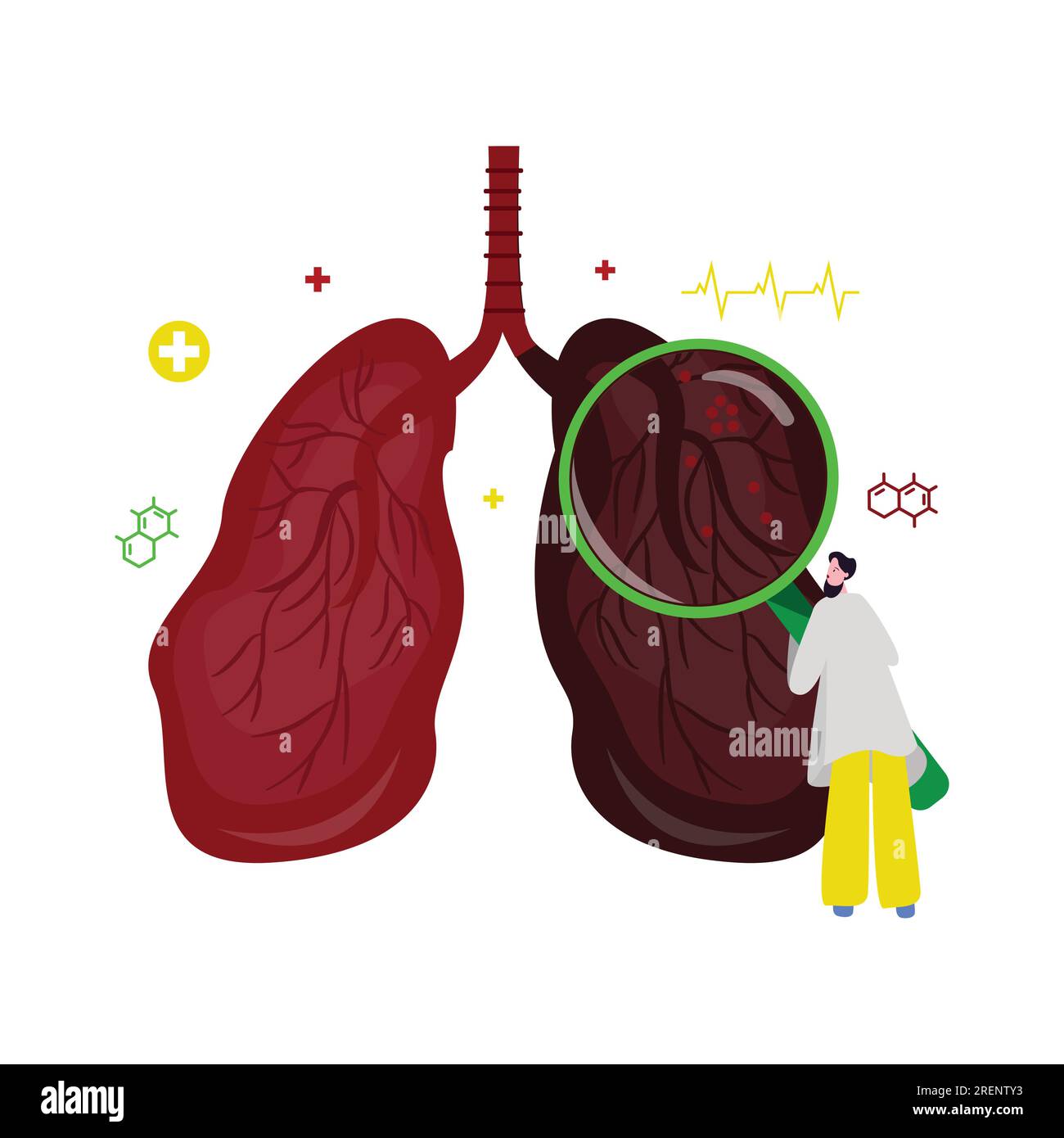 lung body organ anatomy unhealthy disease respiratory system human ...