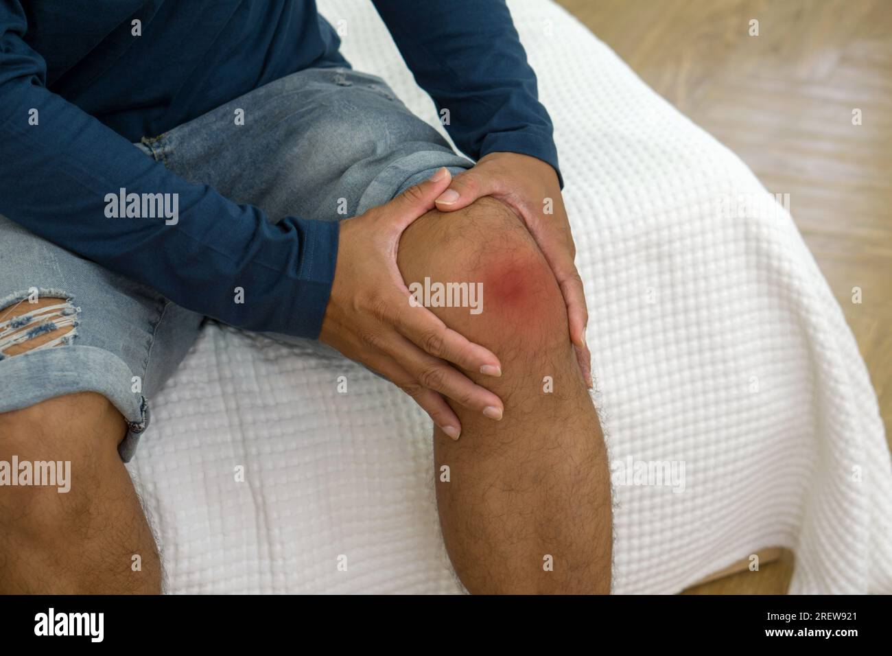 Injured man with painful knee resting on bed in an indoor setting ...