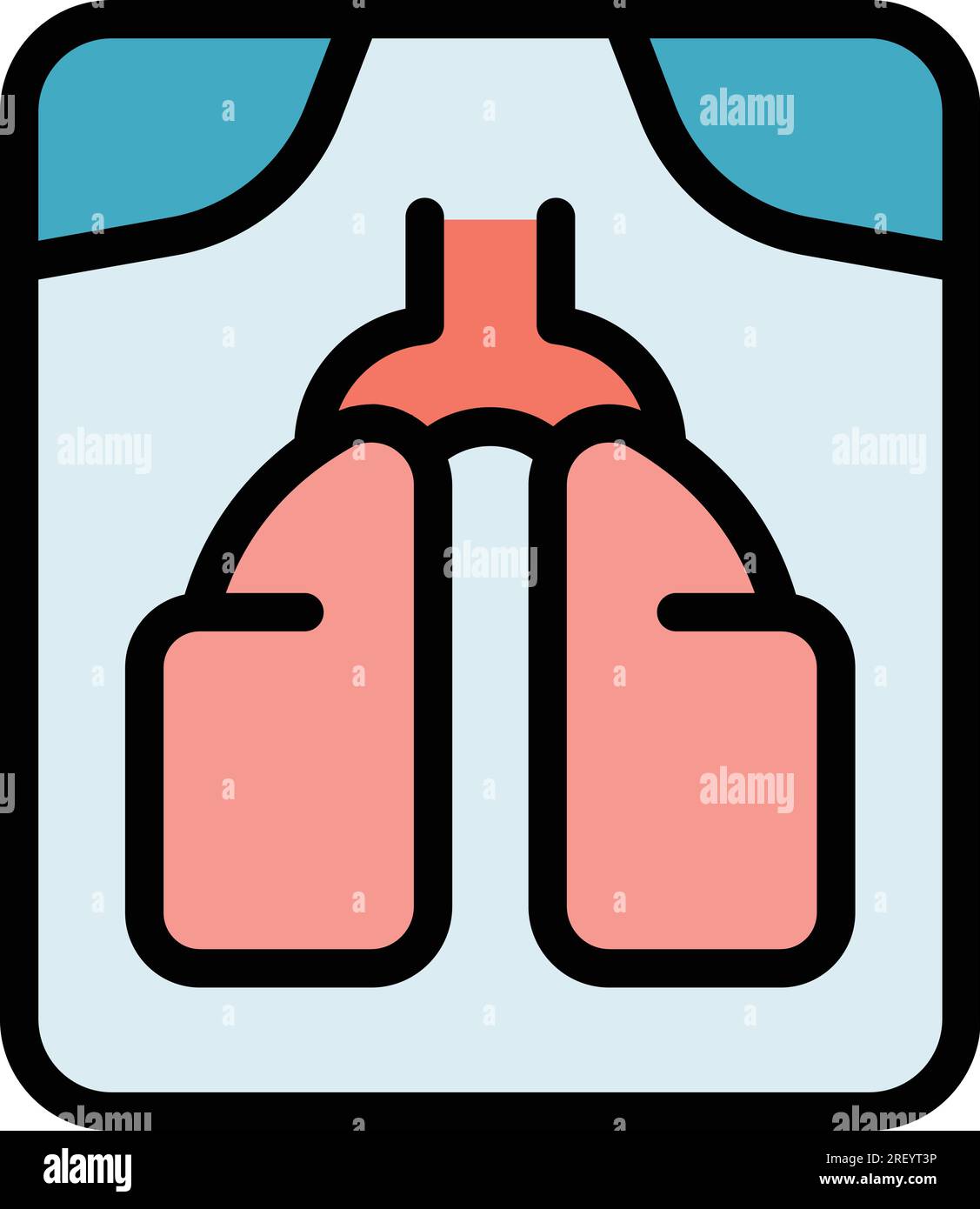 Chest x ray of child Stock Vector Images - Alamy