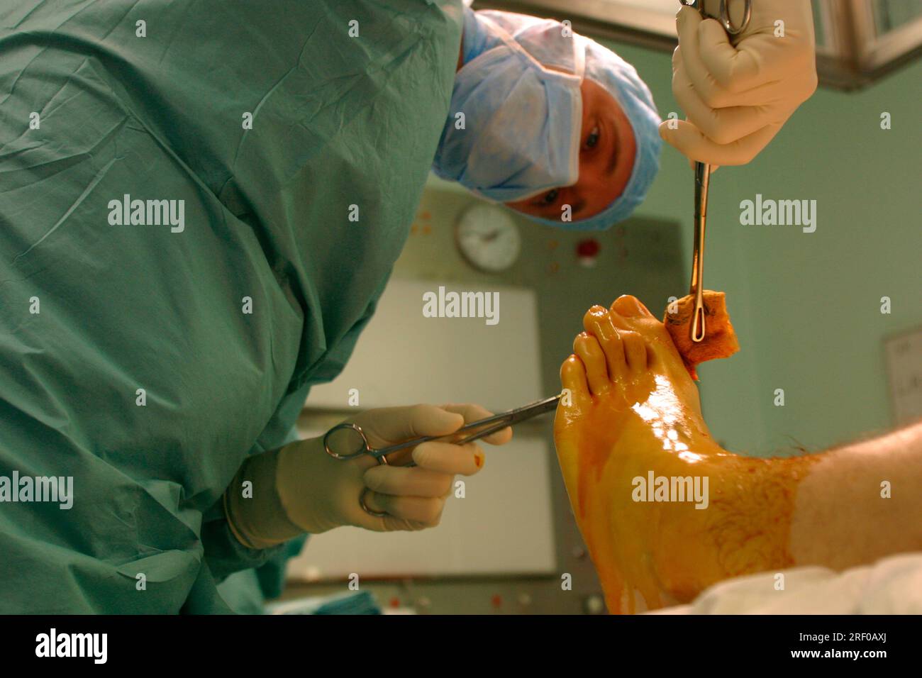 Hospital nhs theatre hi-res stock photography and images - Alamy