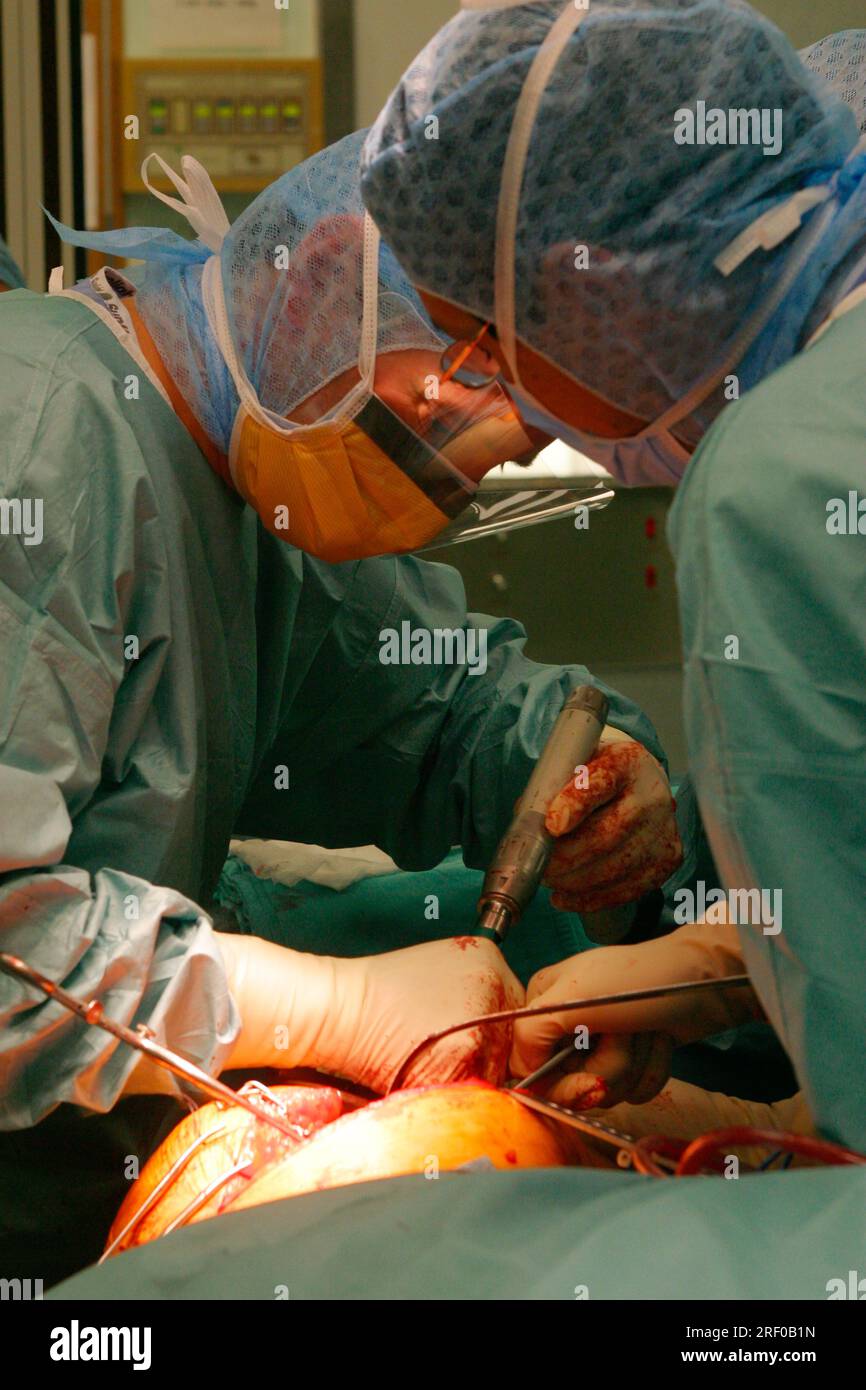 Medical team performing hip replacement surgery in a hospital operating ...