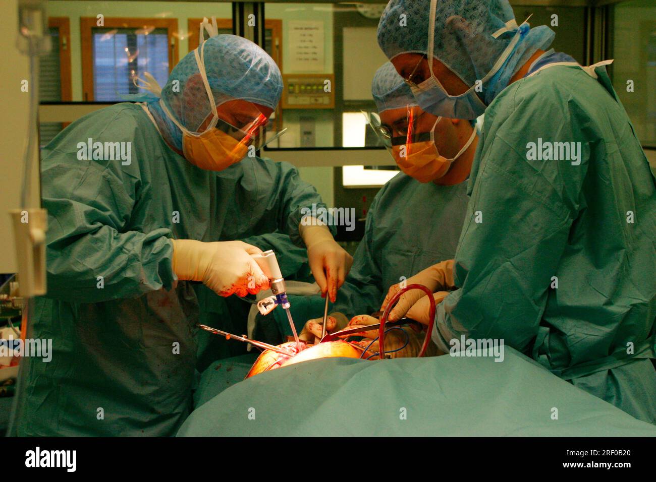 Medical team performing hip replacement surgery in a hospital operating ...