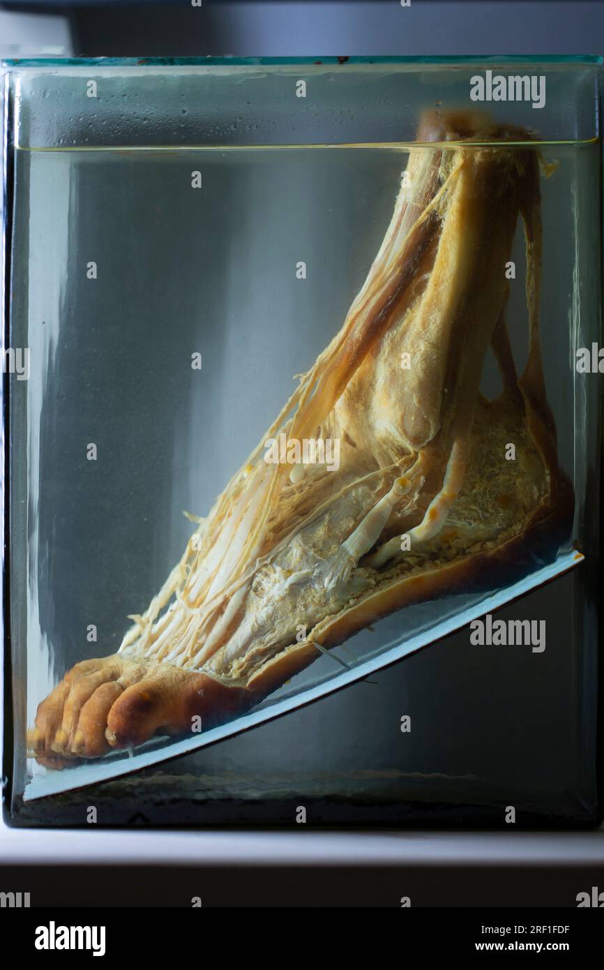 April 1, 2023. Gomel. Exhibition of anatomical exhibits. The ...