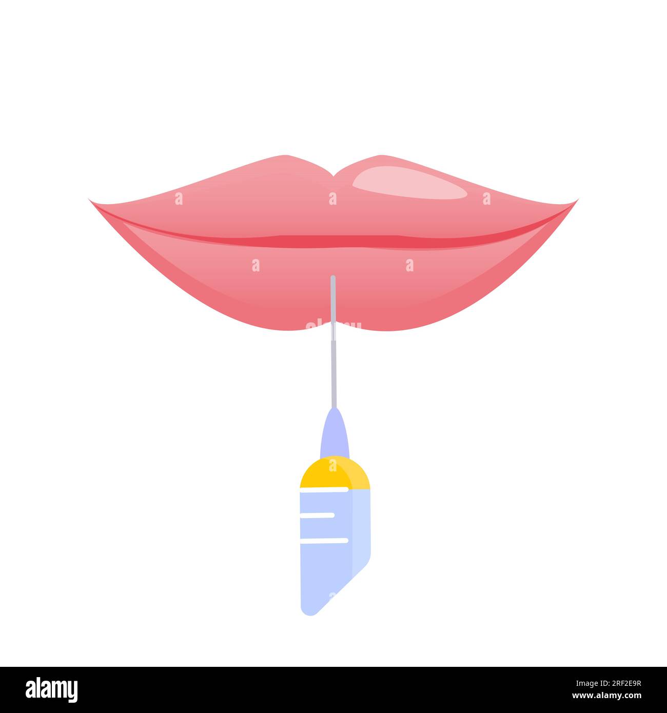 Lip plumping augmentation with filler injection illustration Stock ... Lip plumping augmentation with filler injection illustration Stock ...