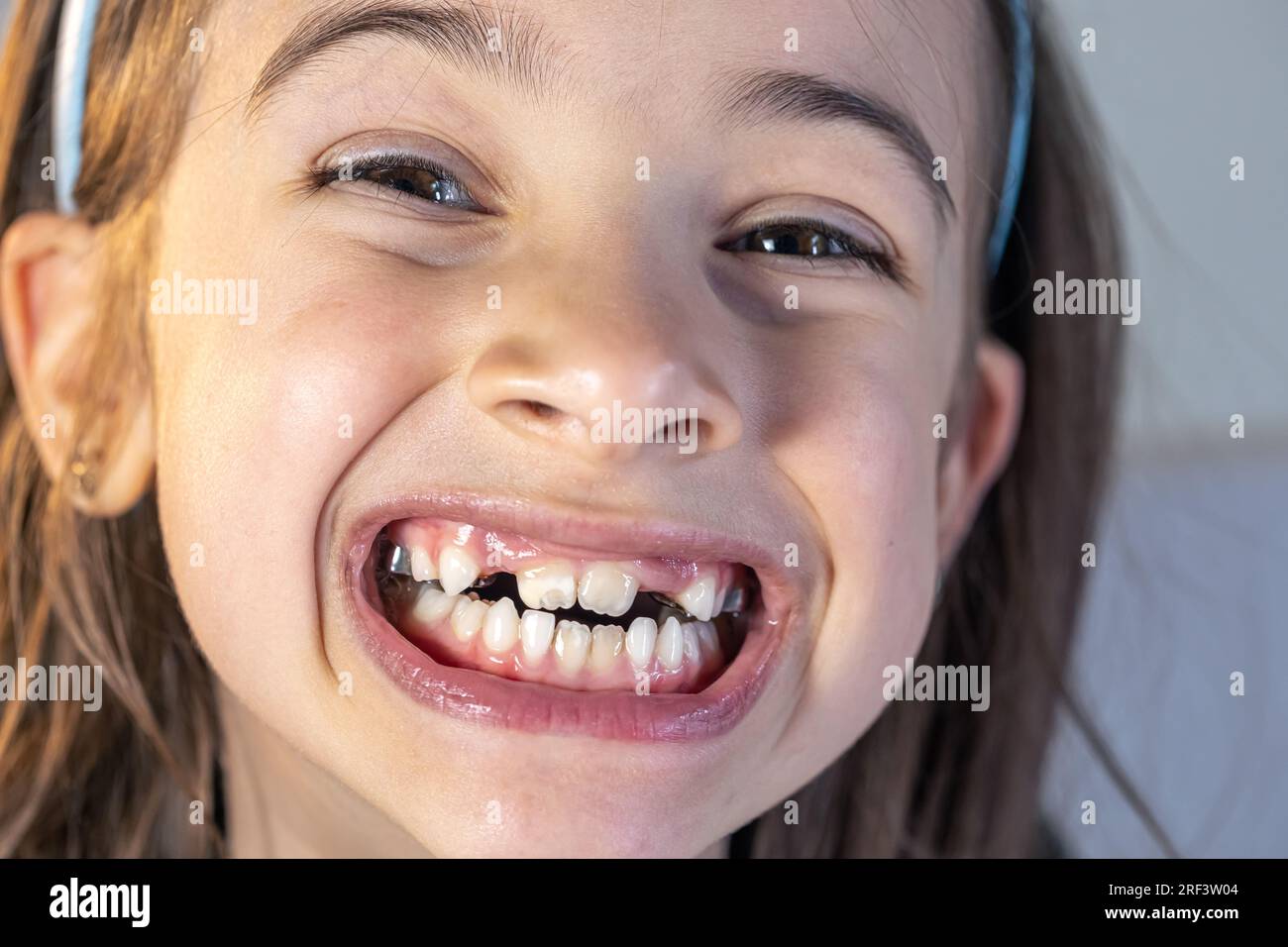 Child during orthodontist visit and oral cavity check-up Stock Photo ...