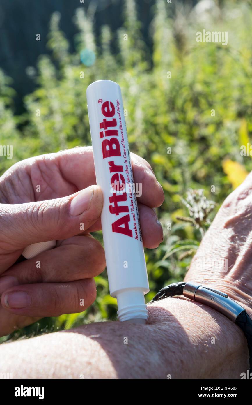 Insect bite hi-res stock photography and images - Alamy