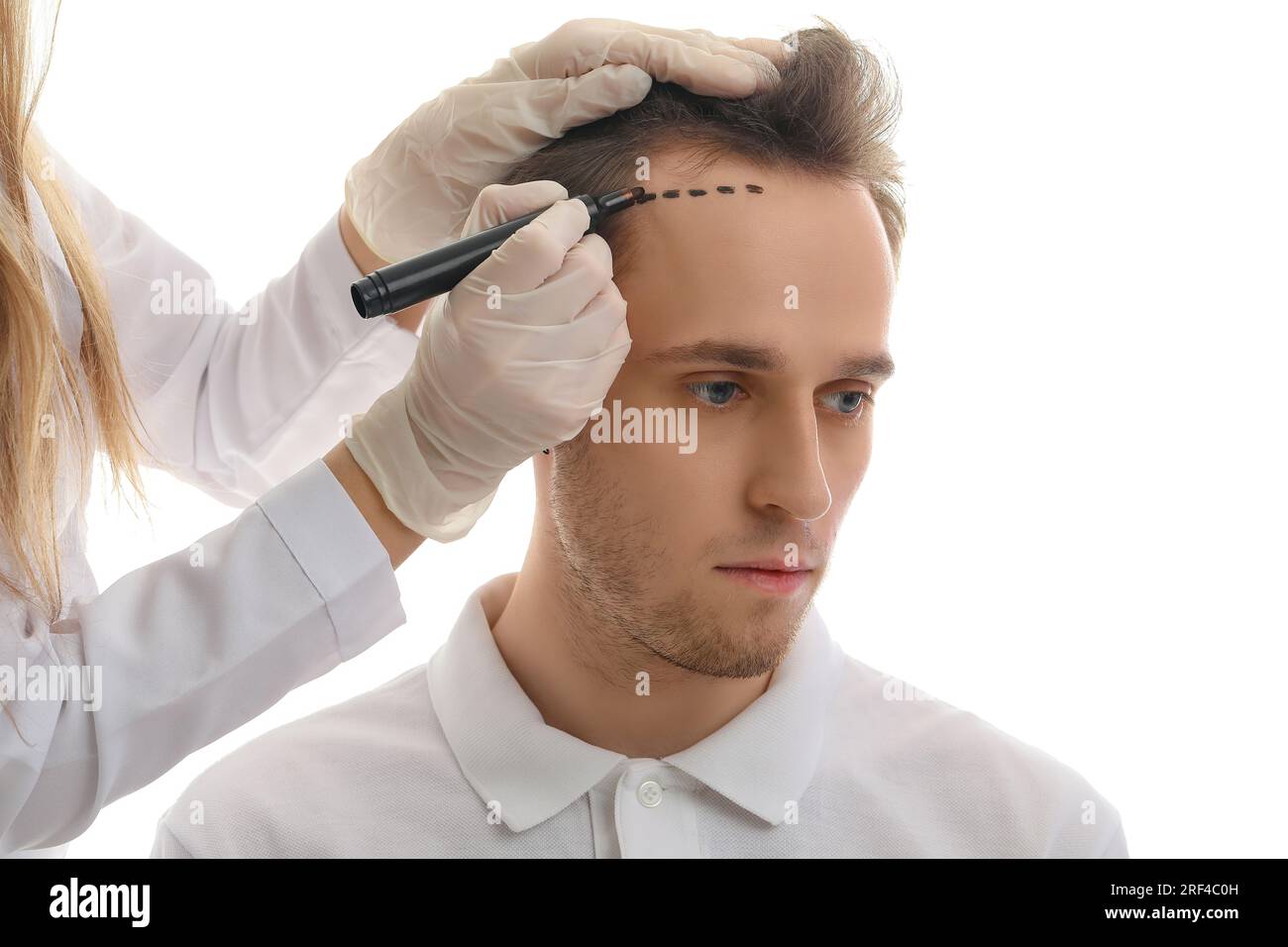 Doctor marking young man's forehead with hair loss problem on white ...