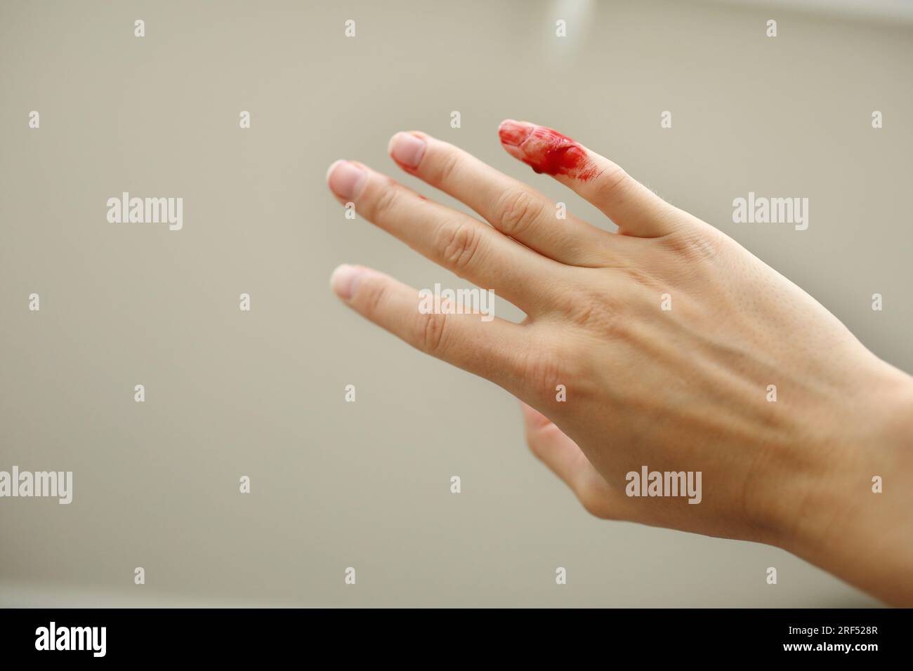 Cut Finger Bleeding Profusely