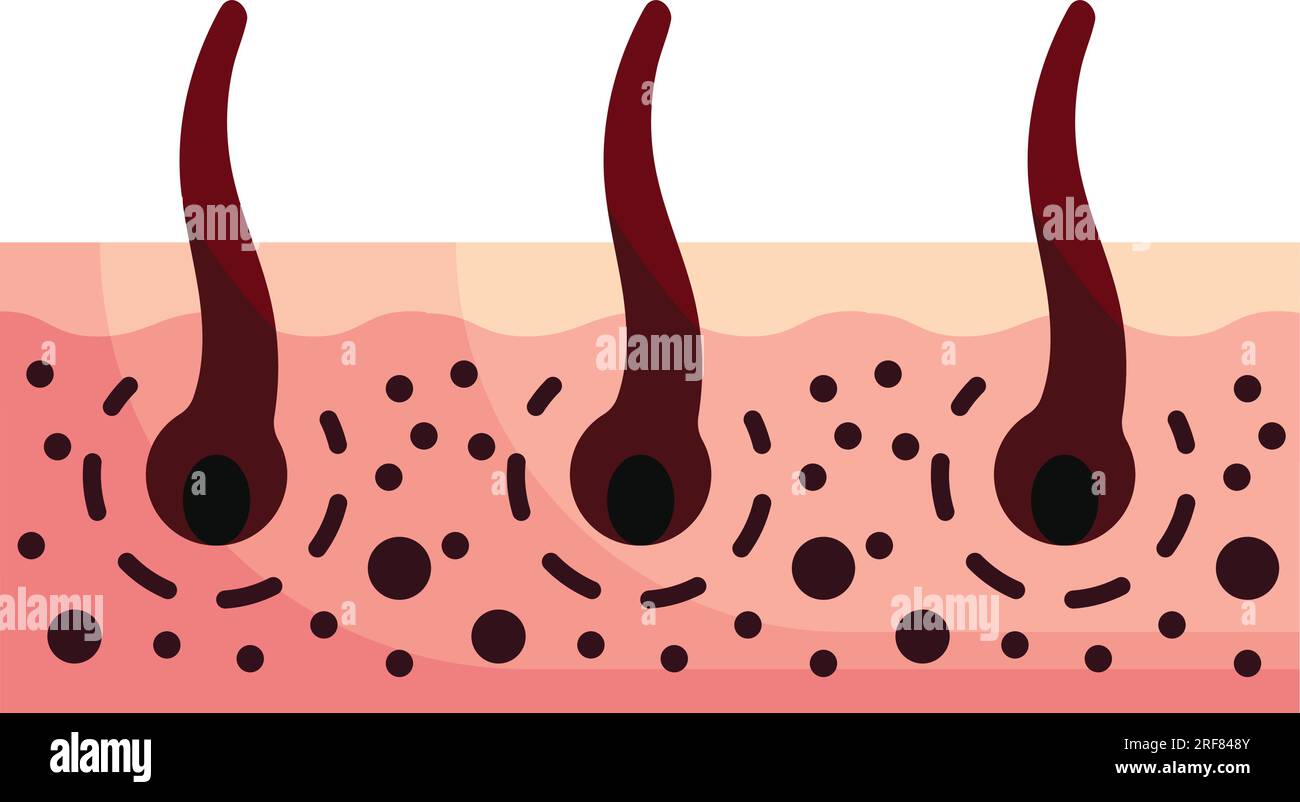 Dermatitis And Skin Allergies Vector Icon Design Beauty And Personal
