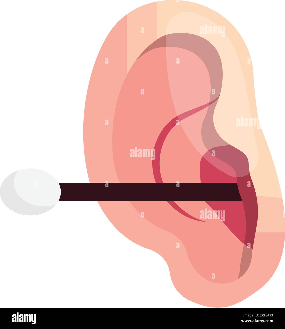 Myringotomy Stock Vector Images - Alamy