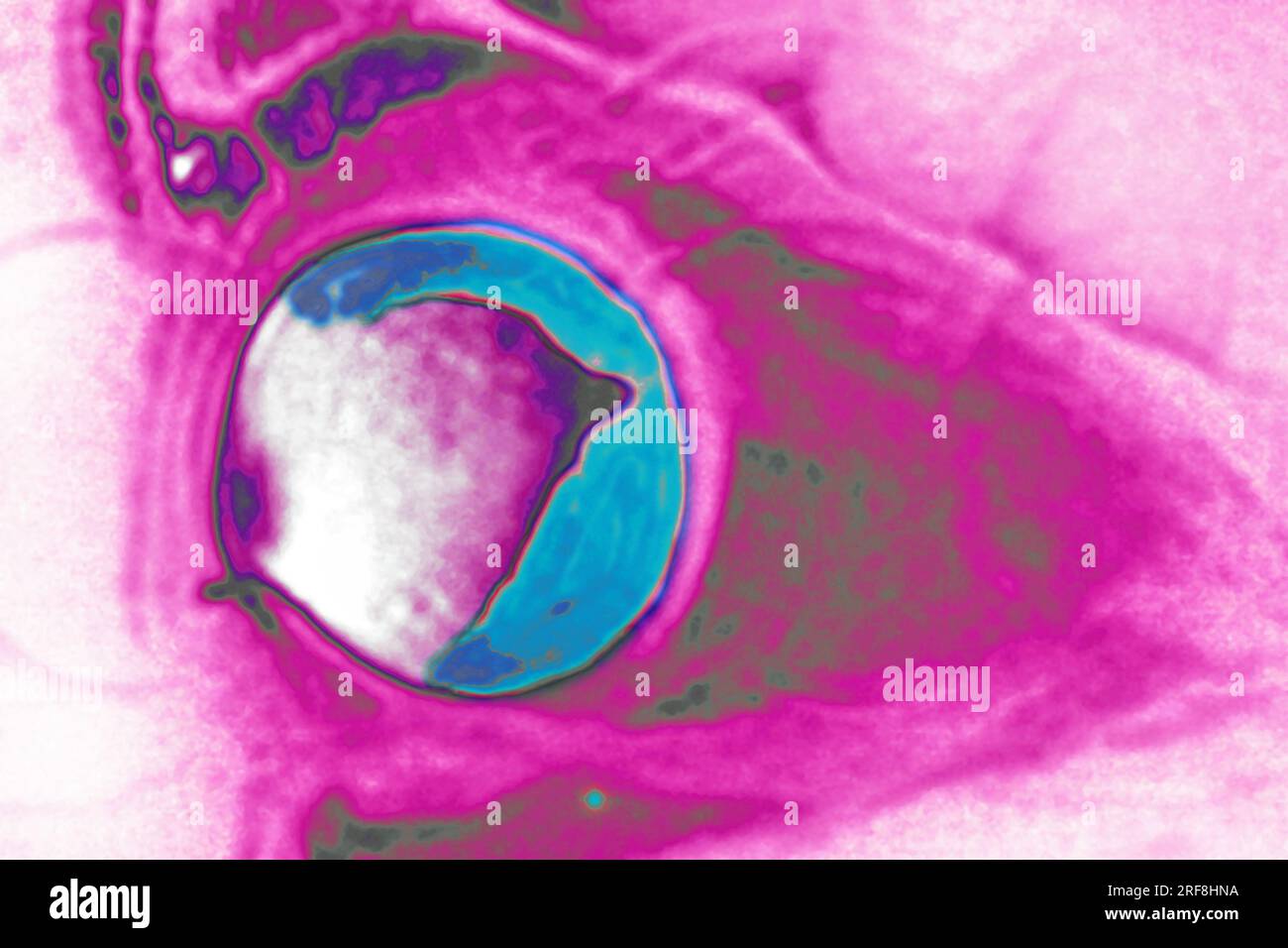 Head mri optic nerve hi-res stock photography and images - Alamy