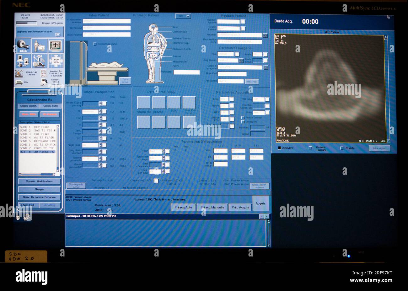 MRI (magnetic resonance imaging) screen of the head and neck Stock ...