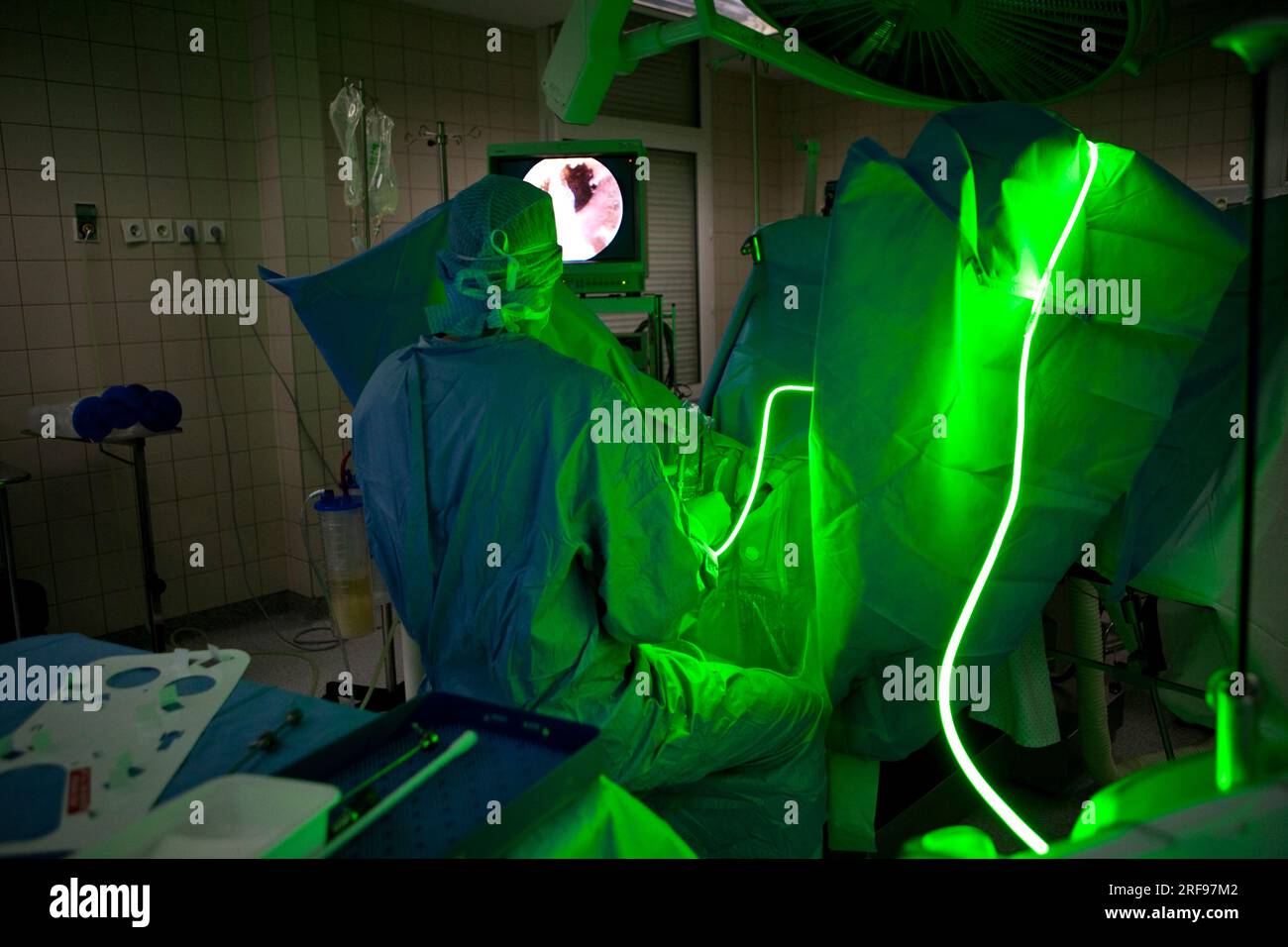 Laser surgery for the treatment of benign prostatic hyperplasia Stock ...