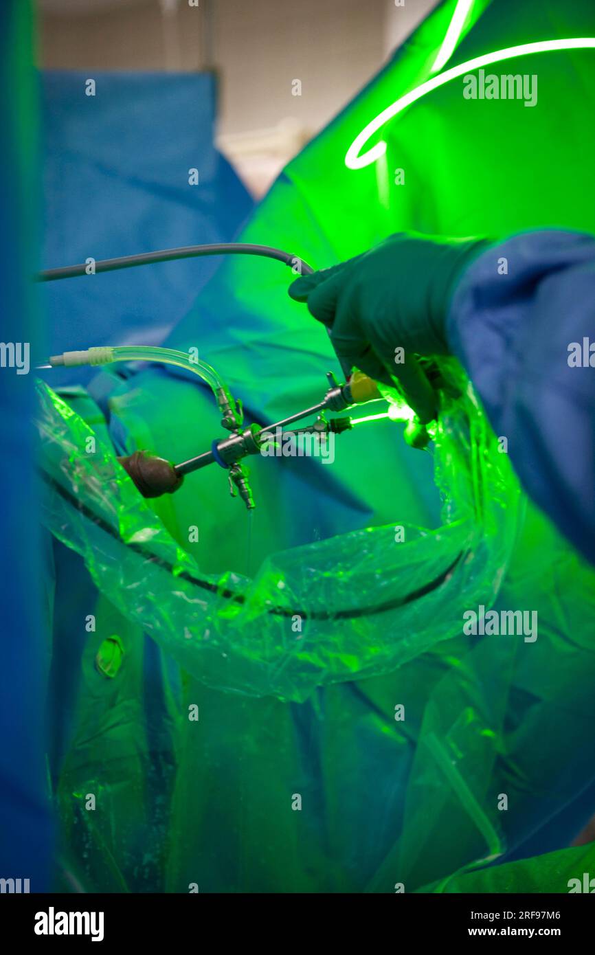 Laser surgery for the treatment of benign prostatic hyperplasia Stock ...