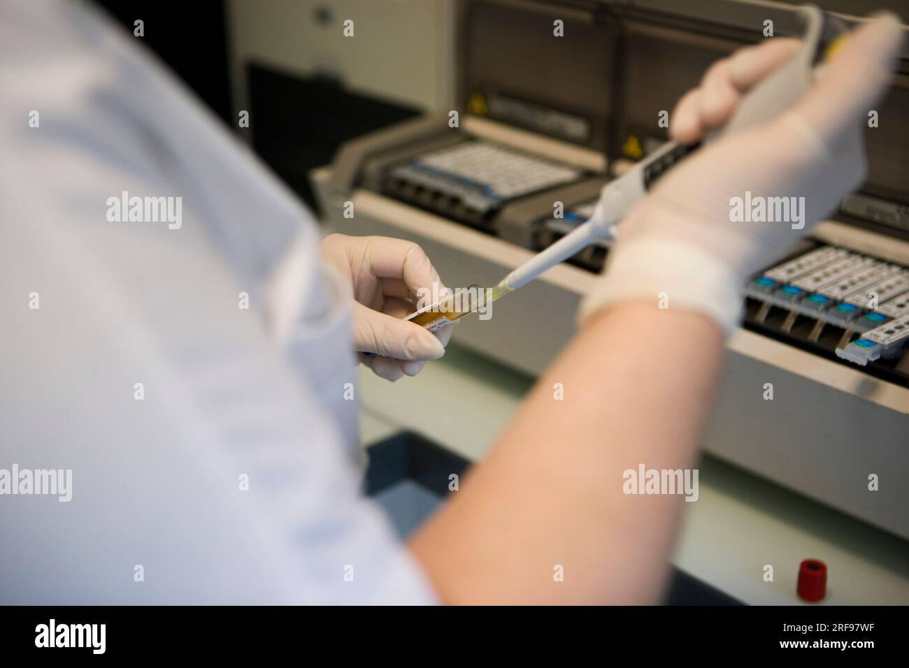 Immunology machine for toxoplasmosis, cytomegalovirus and HIV ...