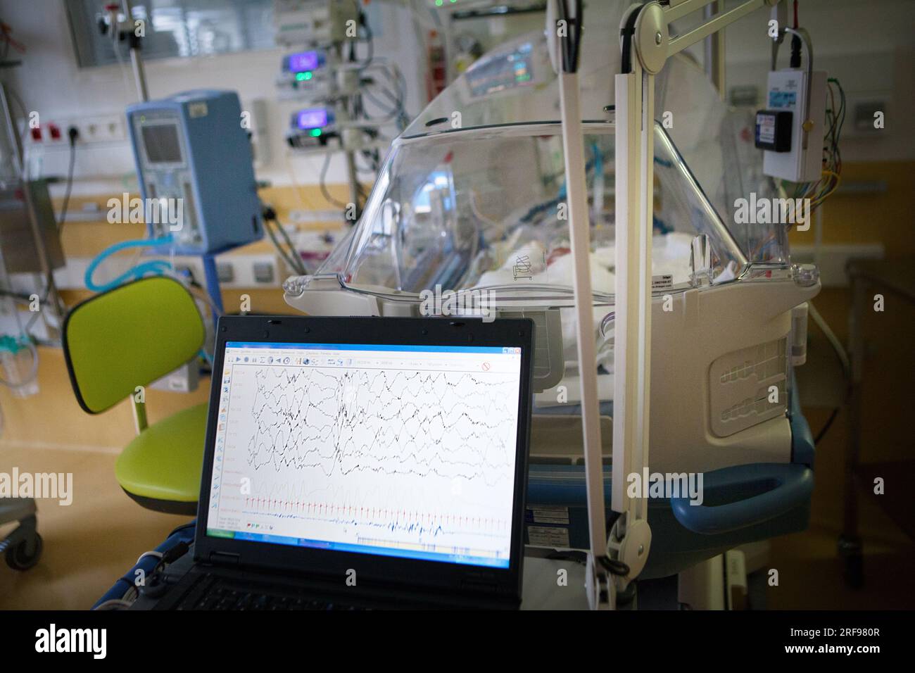 The control electroencephalogram on premature babies is used to monitor ...