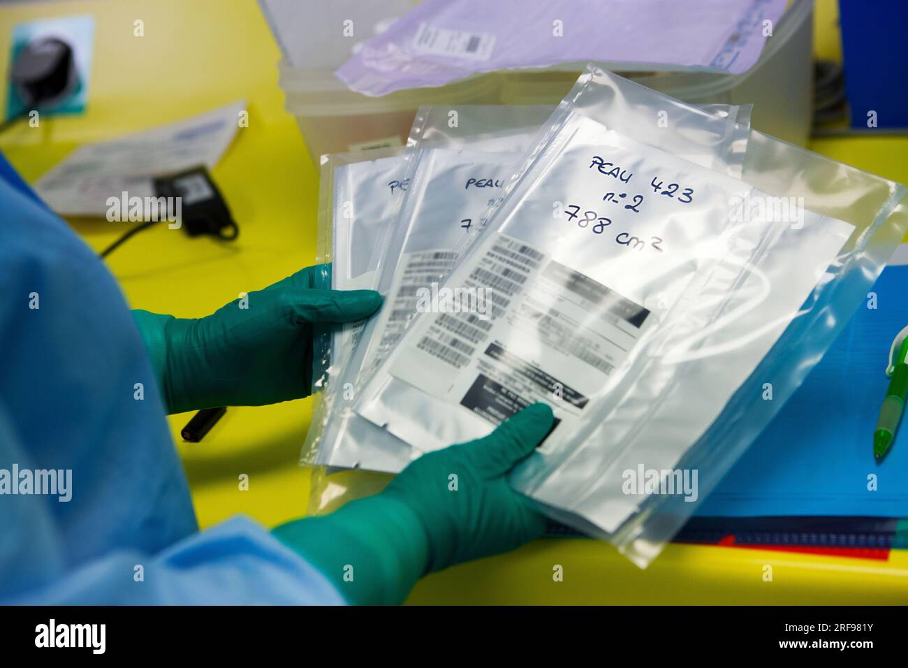 Skin taken from donors and sent to the biobank, preparation of skin ...