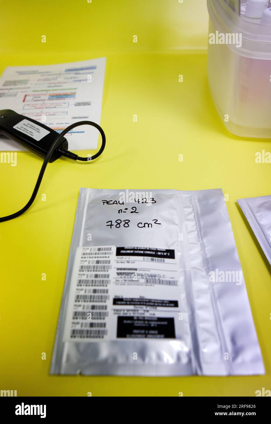 Skin taken from donors and sent to the biobank, preparation of skin ...