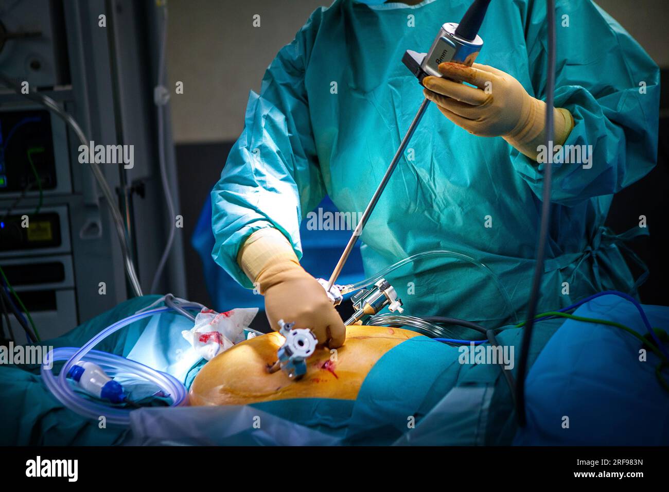Hysterectomy in the operating room with a robot surgeon, installation ...