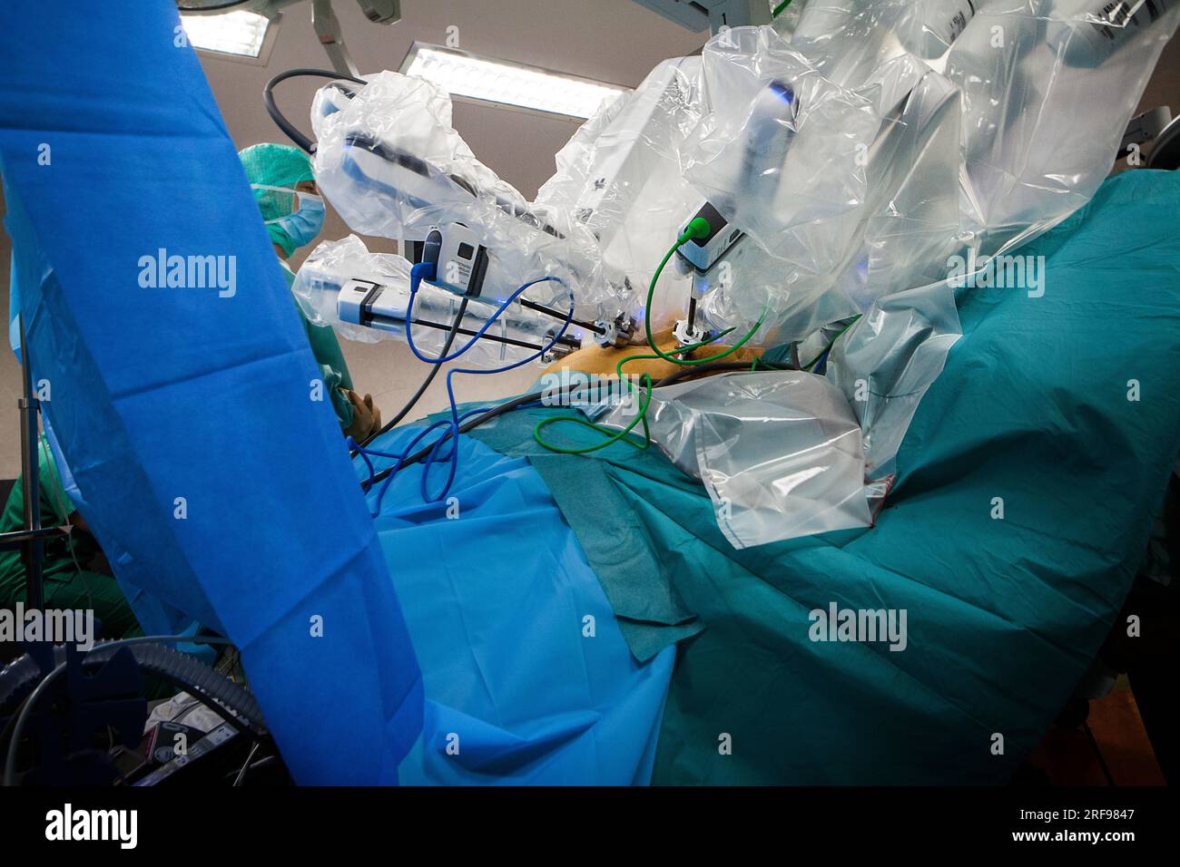 Hysterectomy in an operating room of a hospital with a robot surgeon ...