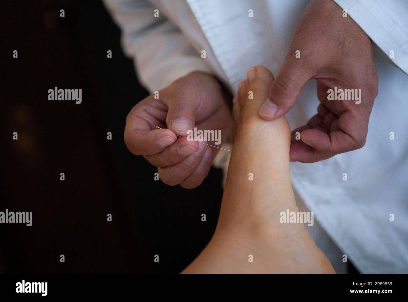Acupuncture practice hi-res stock photography and images - Alamy