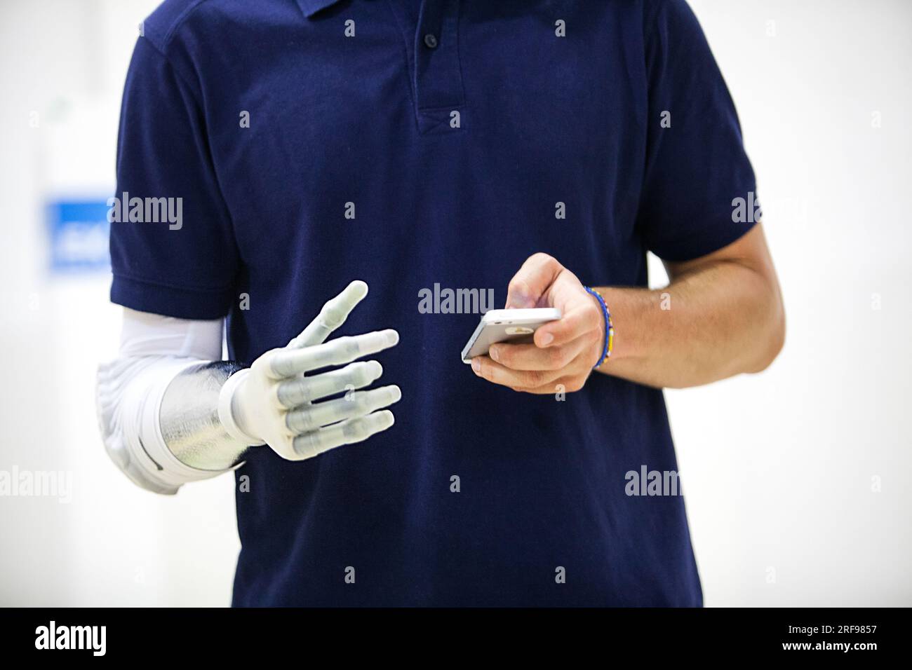 Man equipped with a robotic arm prosthesis Stock Photo - Alamy