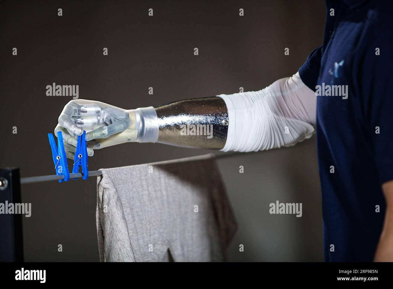 Person equipped with a robotic arm prosthesis Stock Photo - Alamy