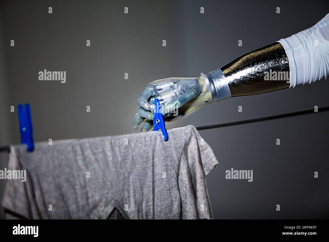 Person equipped with a robotic arm prosthesis Stock Photo - Alamy