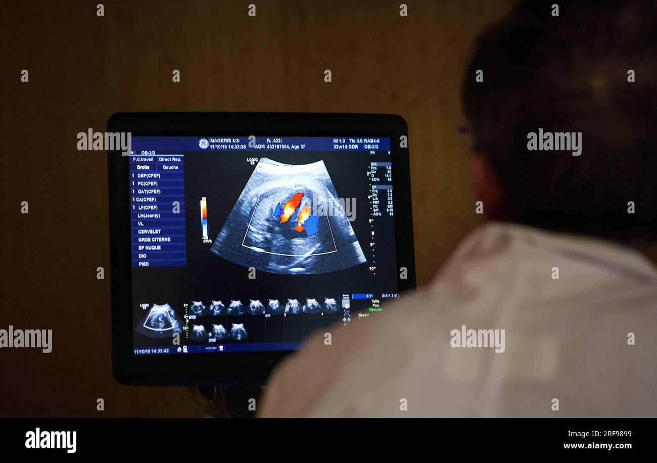 Doctor performs ultrasound examination pregnant hi-res stock ...