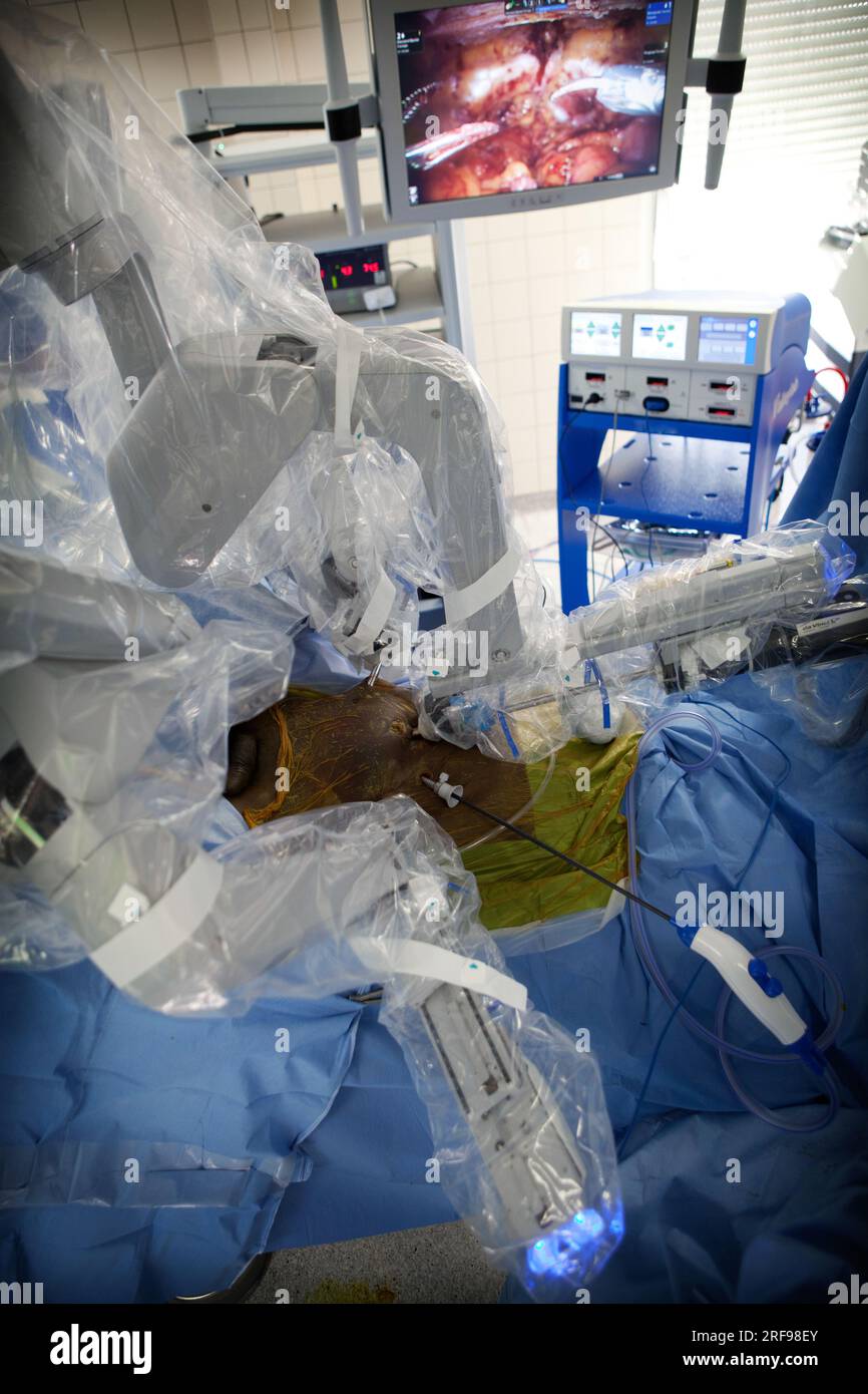 Urology department of a hospital performing prostatectomies using a ...