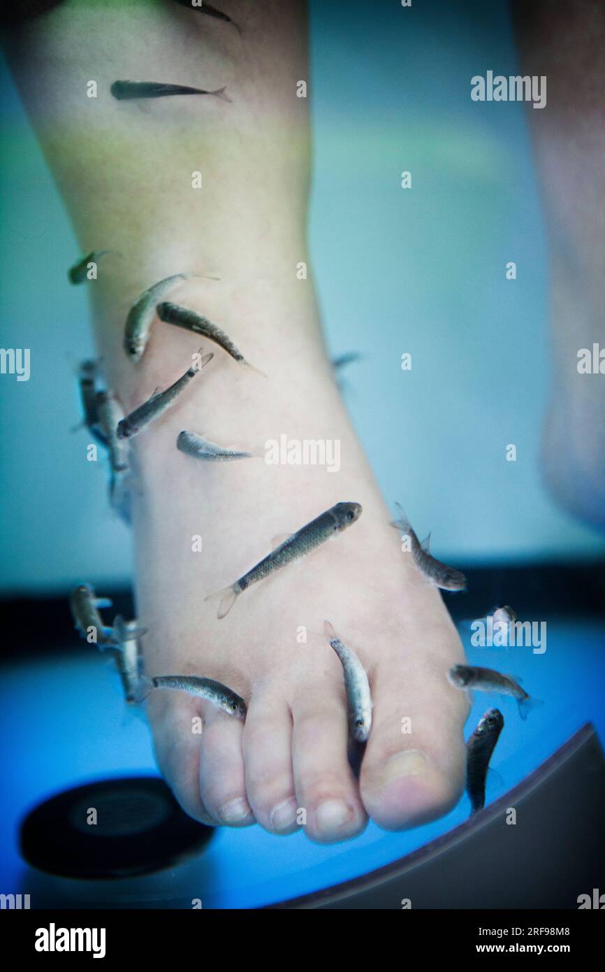 Garra rufa fish feed on dead skin and are used to treat wounds or ...