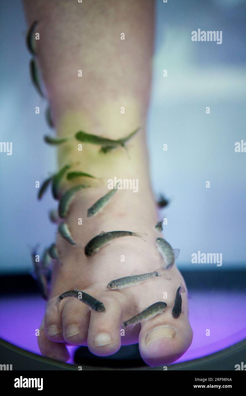 Garra rufa fish feed on dead skin and are used to treat wounds or ...