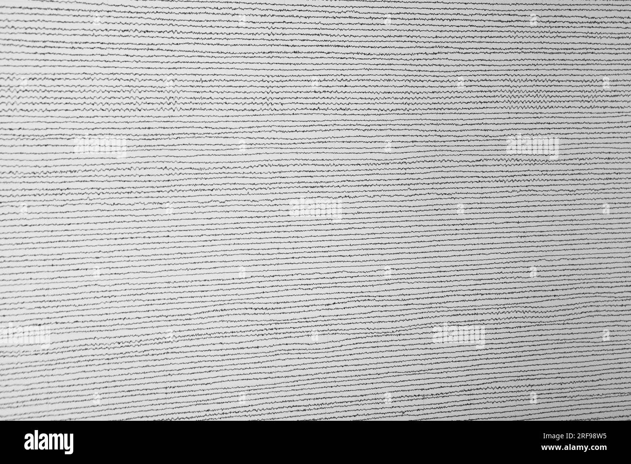 Magnetoencephalography (MEG) is a neuroimaging that records the ...