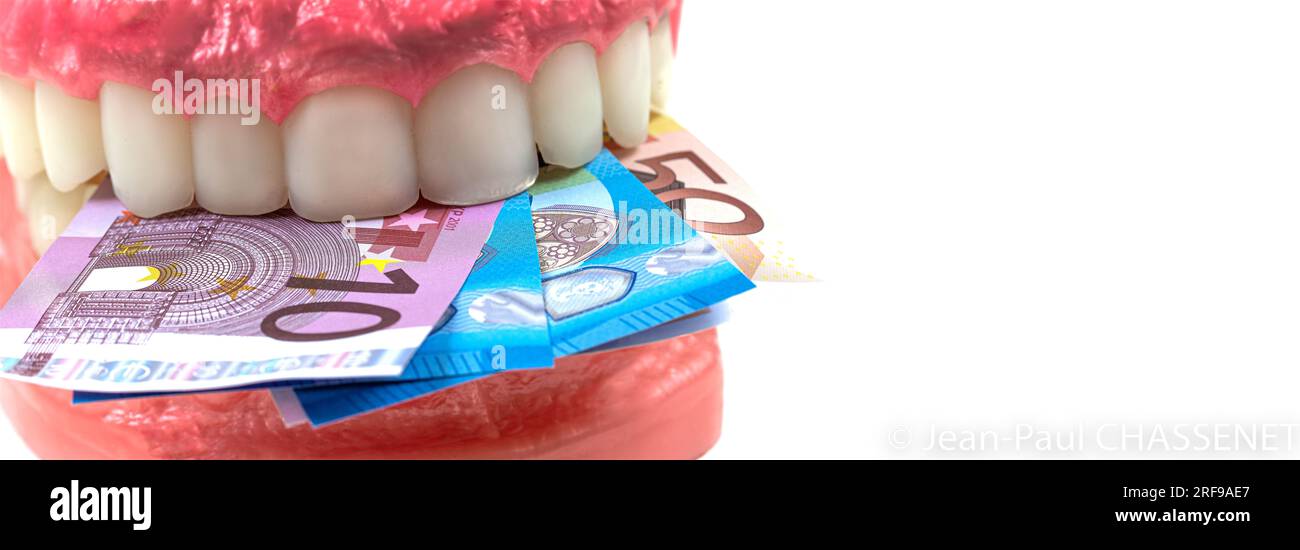 Banknotes in a typodont representing the cost of dental treatment Stock ...