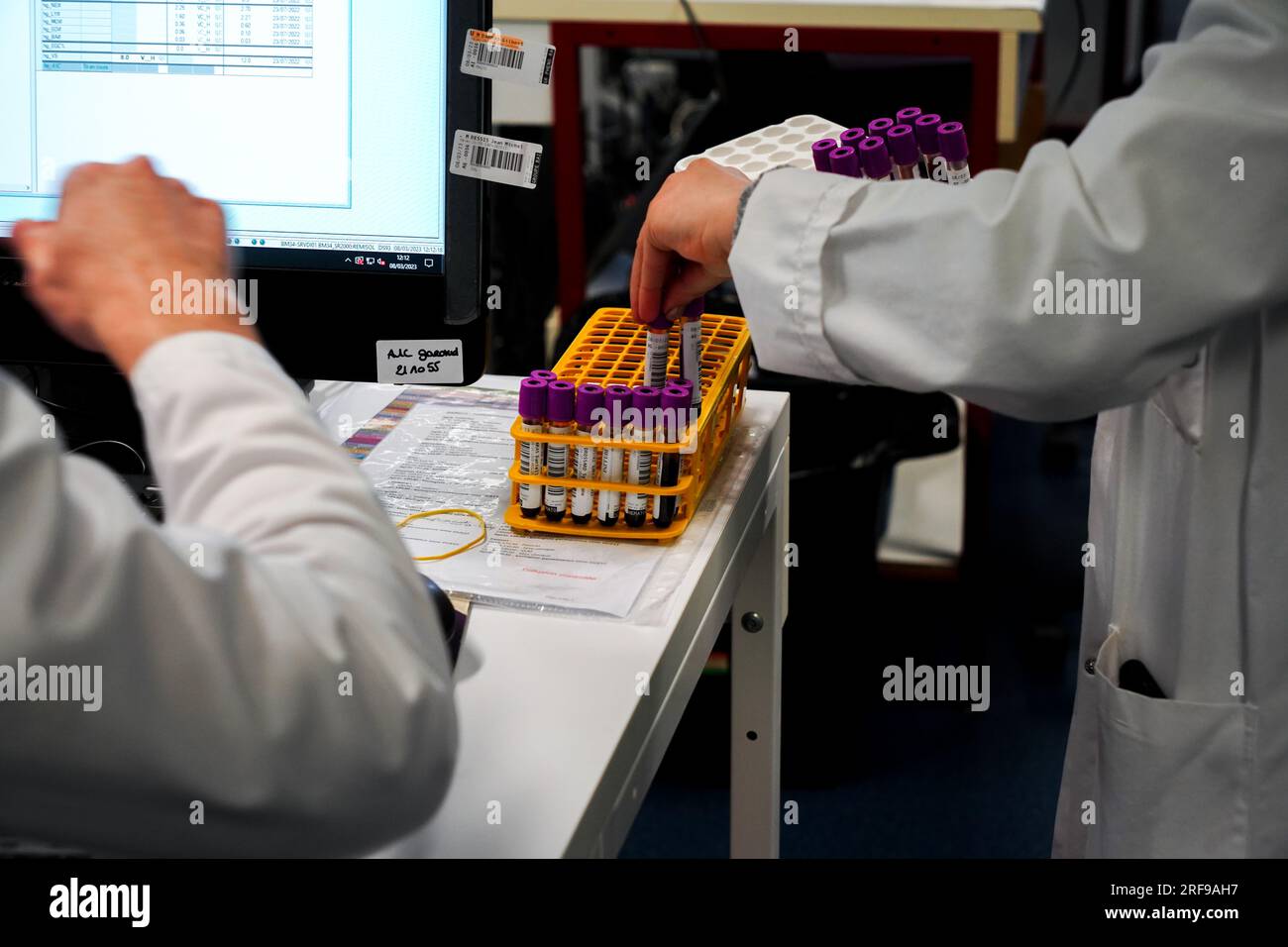 Technical platform of the Inovie 34 laboratory . Validation of NFS results, blood count and ESR ...